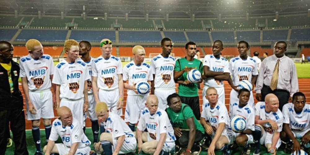 La historia del equipo de albinos que salvó vidas en Tanzania